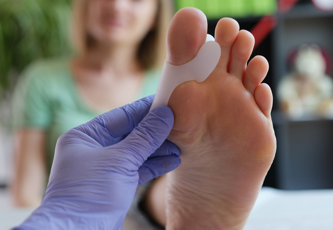 Orthoplasties - Orthèses d’orteils - Appareillages sur-mesure
